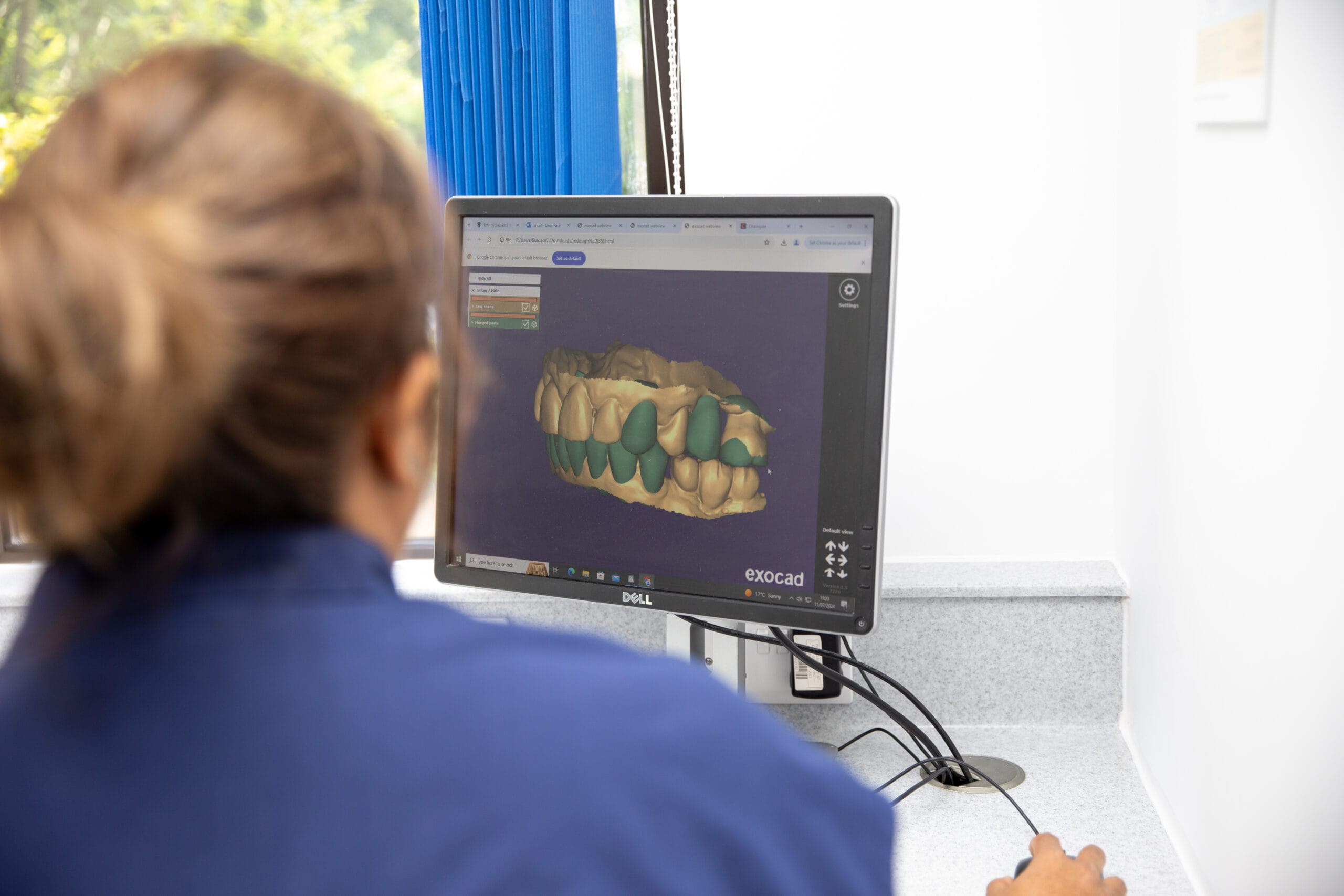 Digital Dentistry - Dentist Four Marks